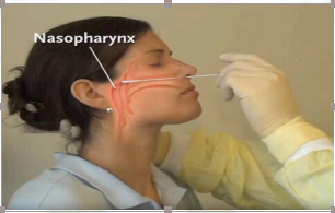 Antigen Rapid Test (Tes Cepat Antigen) - Prodia OHI